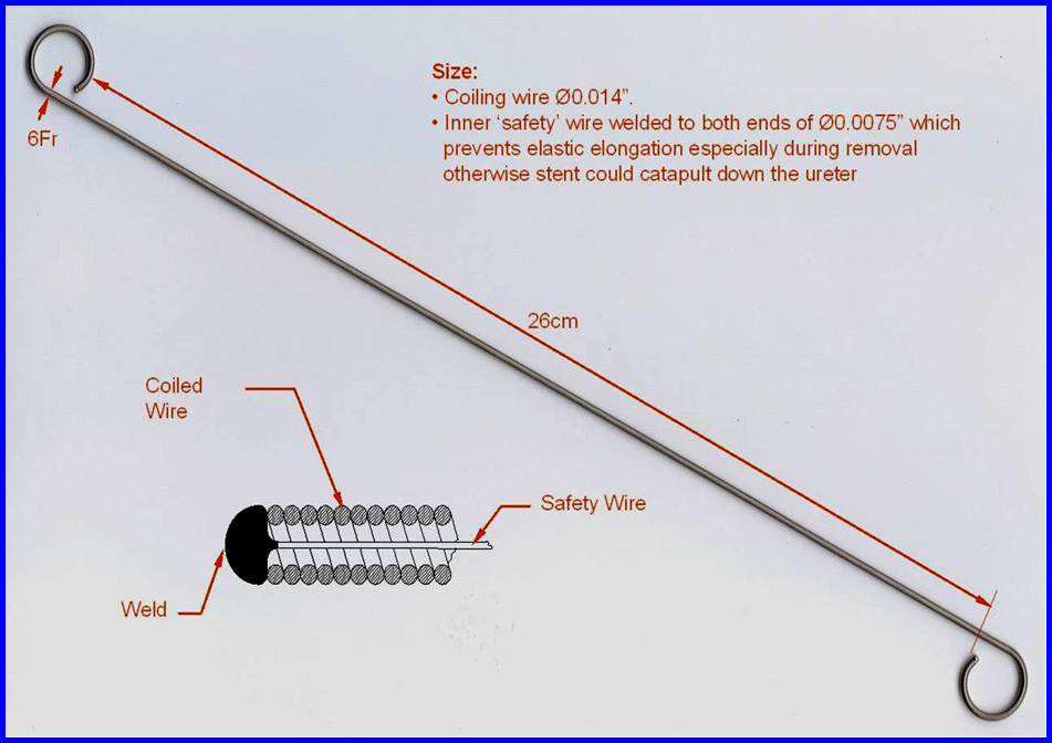 Stent construction