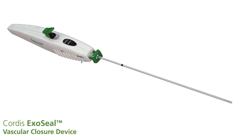 Editorial | A Comparison of Vascular Closure Devices Commonly Used in ...