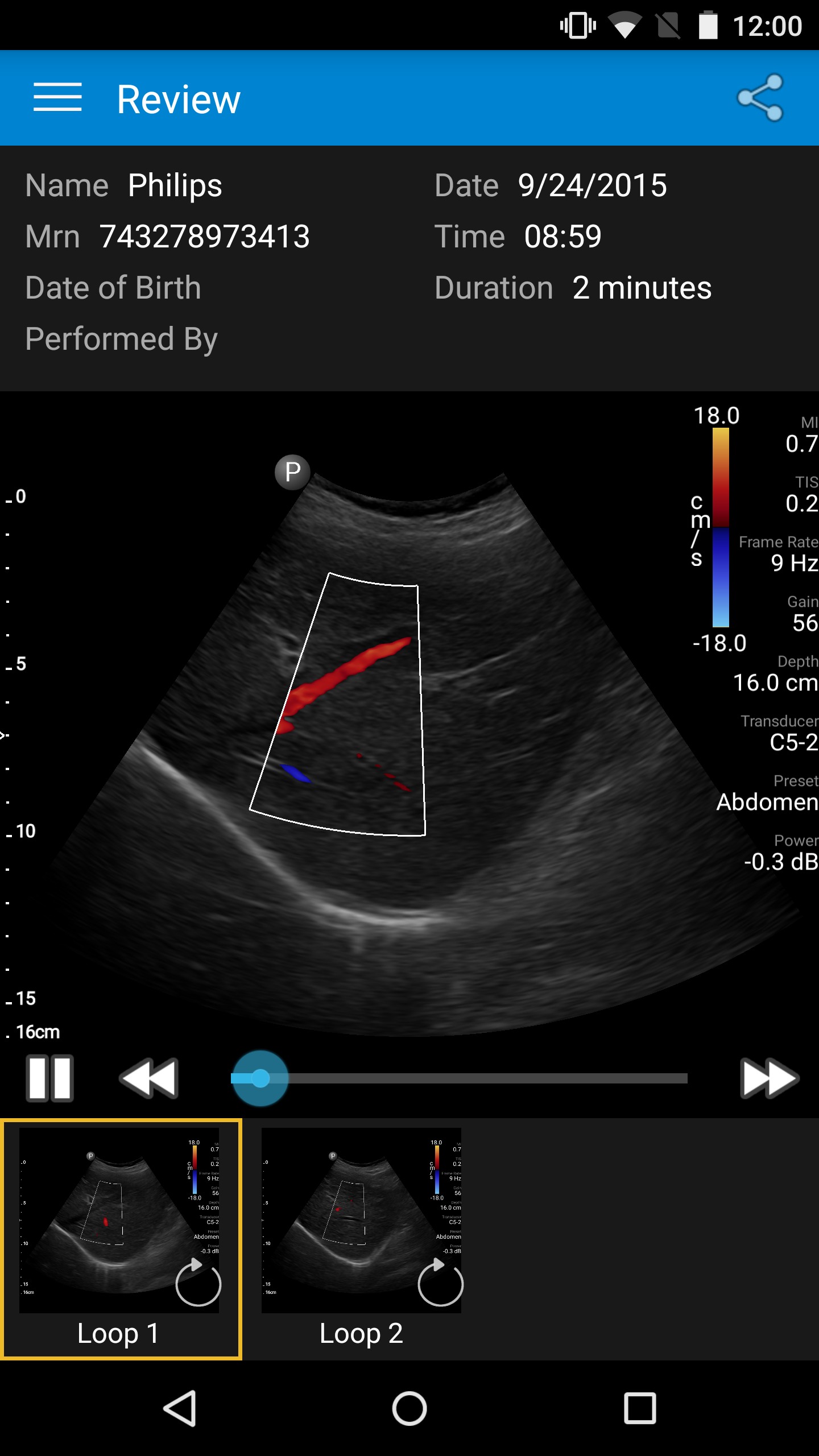 Reviews of the Philips Lumify Ultrasound System