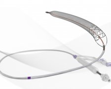 Inari Medical | Inari ClotTriever