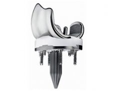 Smith & Nephew | PROFIX Total Knee Replacement System