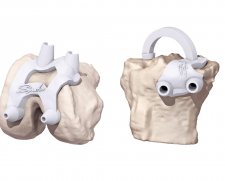 Biomet | Signature Knee Instrumentation