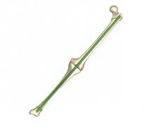 Smith & Nephew | Trigen Knee Fusion Nail