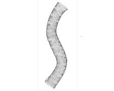 Boston Scientific | VICI VENOUS STENT System
