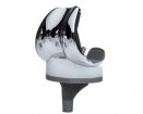 Depuy | PFC Sigma Knee System