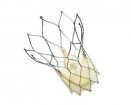 Transcatheter aortic valve implantation (TAVI) | Which Medical Device