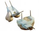 Zimmer | NexGen Knee Replacement System