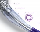 Comments about the Abbott Vascular Supera Peripheral Stent System